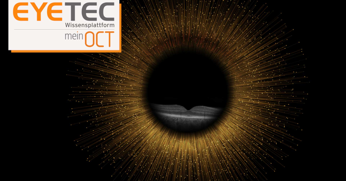 Eyetec GmbH | COE Campus