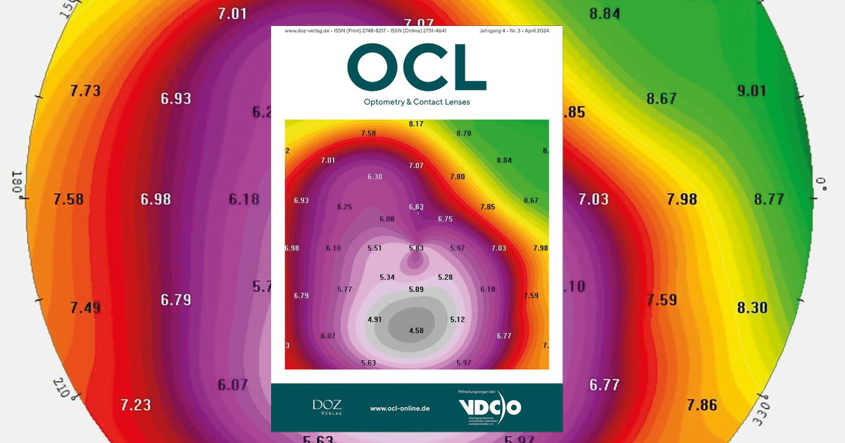 Die neue OCL mit dem Schwerpunkt: "Cornea"