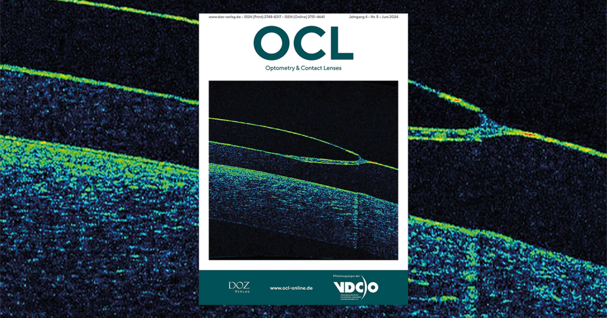 Die neue OCL zum Thema "Kontaktlinsen Update"